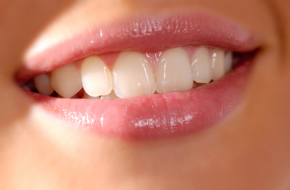 Zoom! Teeth Whitening - Hampsteads Dental